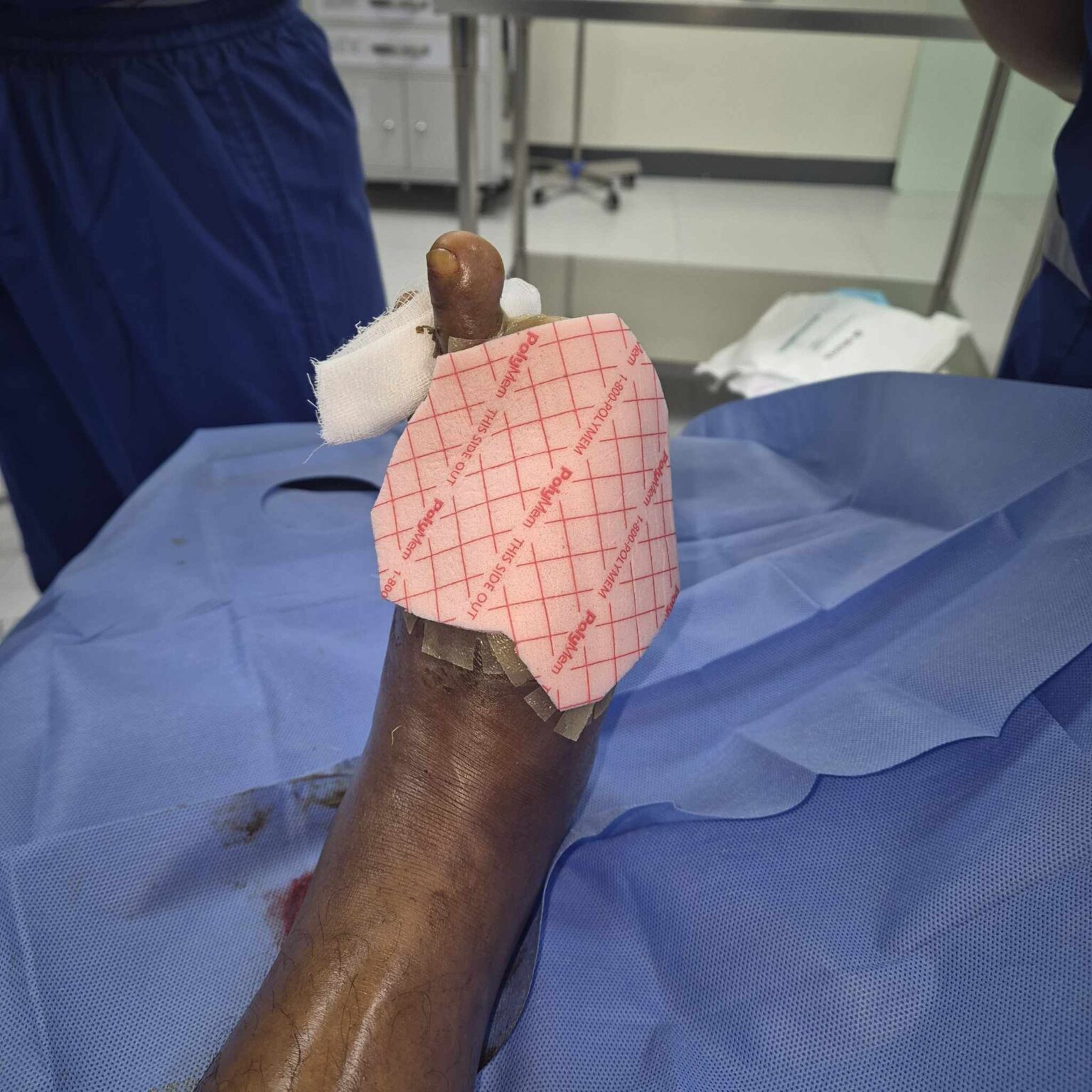 Wound Debridement Services in the Philippines - Kalingap